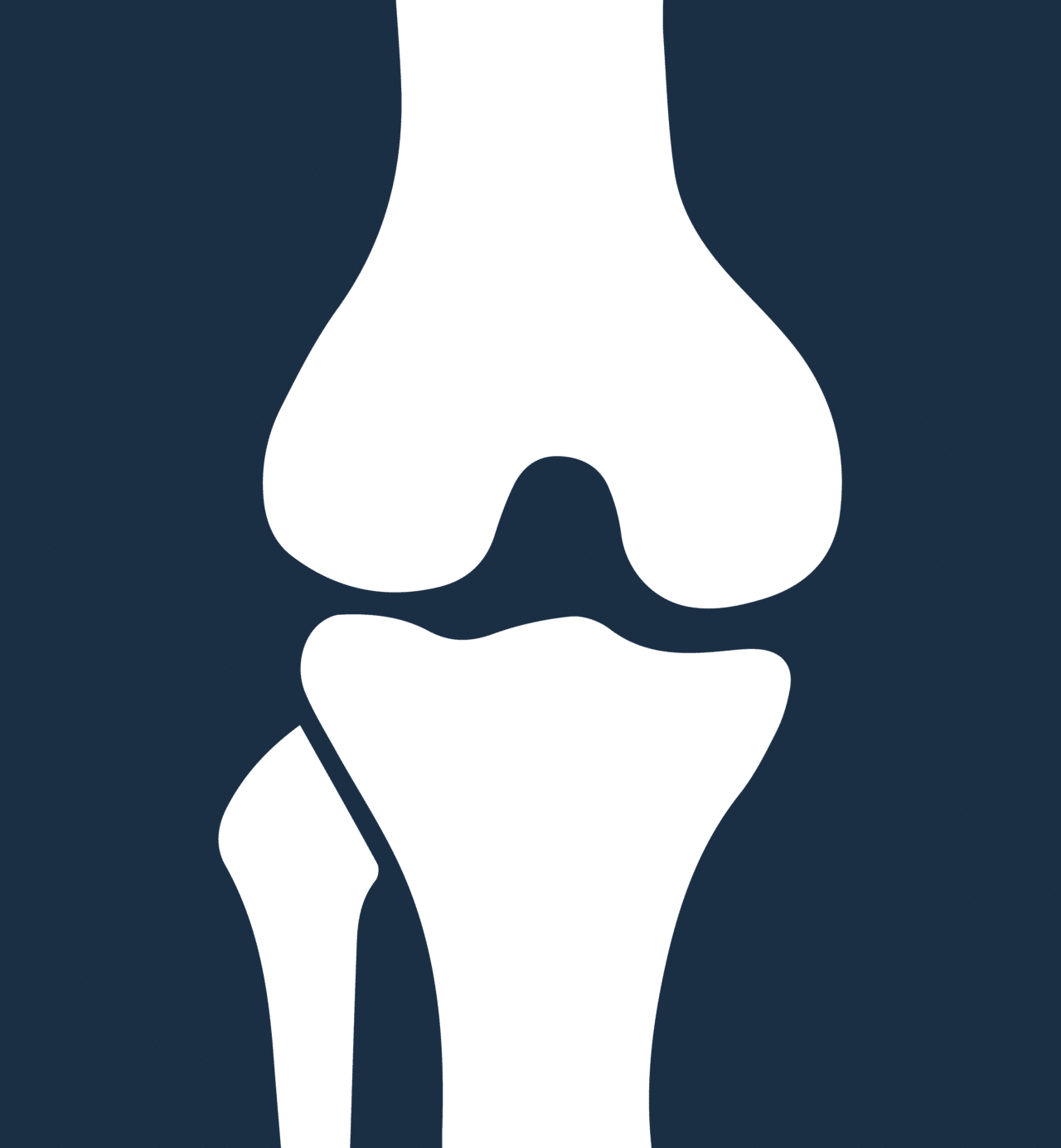 Lésions méniscale - Dr Vincent Villa - Chirurgien orthopédiste