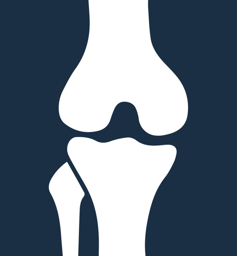 Dysfonctionnement rotulien - Dr Vincent Villa - Chirurgien orthopédiste